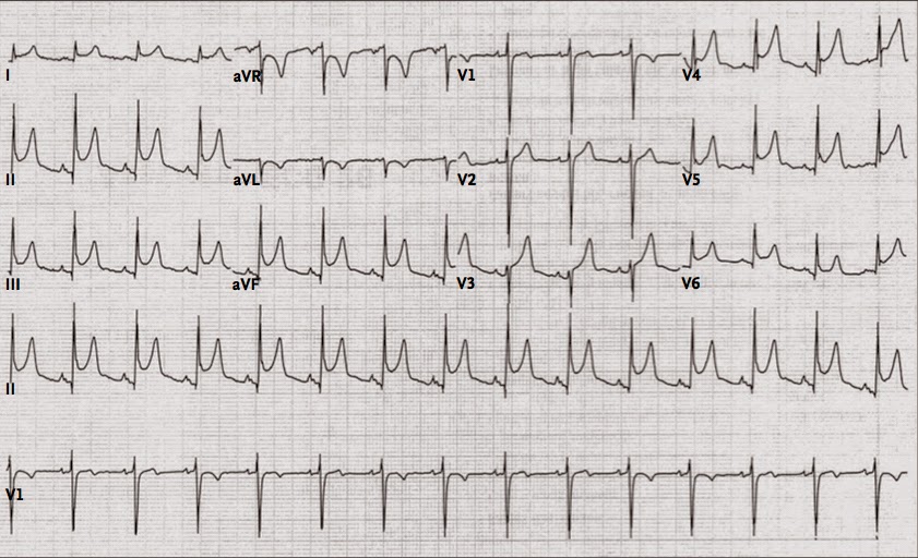 Manuali di Medicina Intensiva: Pericardite in ICU (Capitolo 2.8)