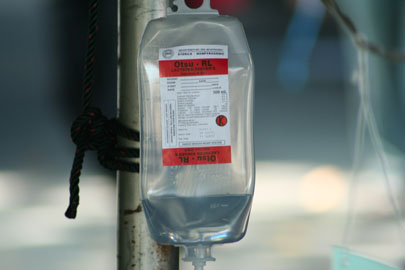 YANZHE INJEKSI: PROSEDUR PEMASANGAN INFUS