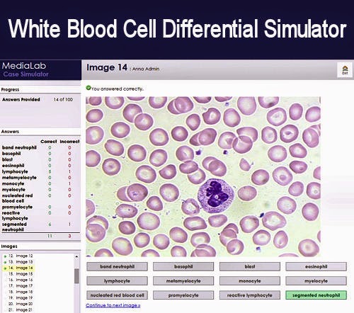 Medical Laboratory and Biomedical Science: White Blood Cell ...