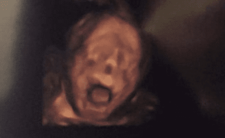 5 Creepy Ultrasound Pictures That Will Make You Question Having ...