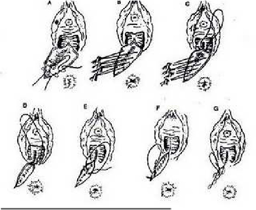 HECTING PERINEUM: HECTING PERENIUM