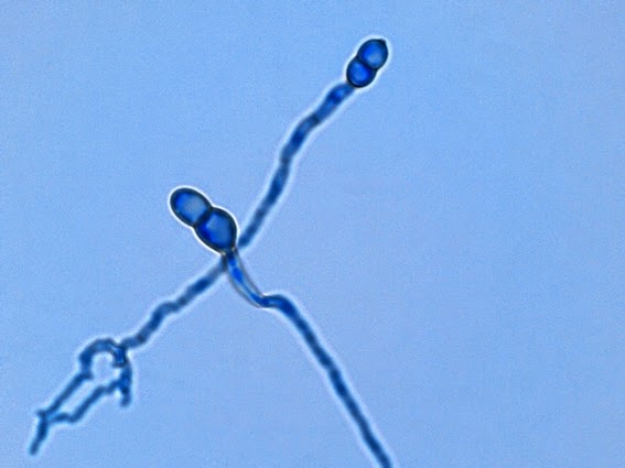 Fun With Microbiology (What's Buggin' You?): Ochroconis species