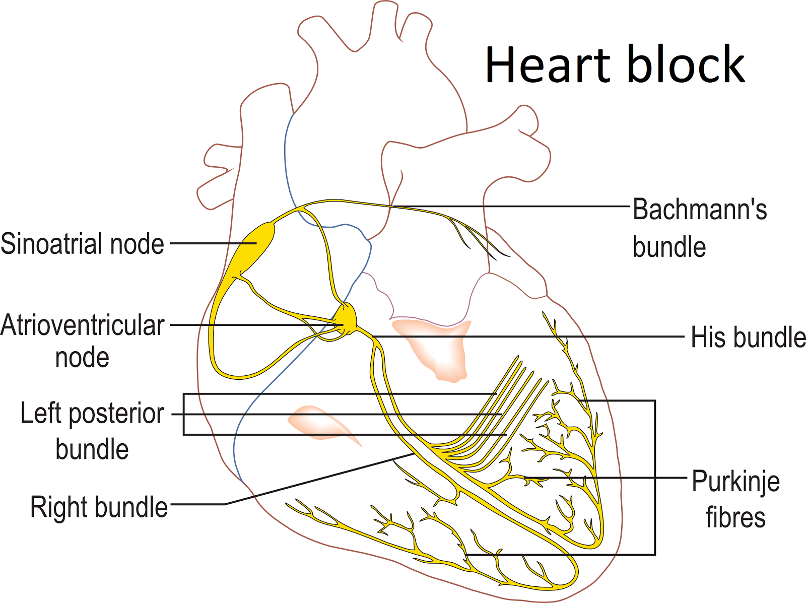 Heart Block Health And Fitness Tips Lifestyle heart-block-health-and-fitness-tips-lifestyle