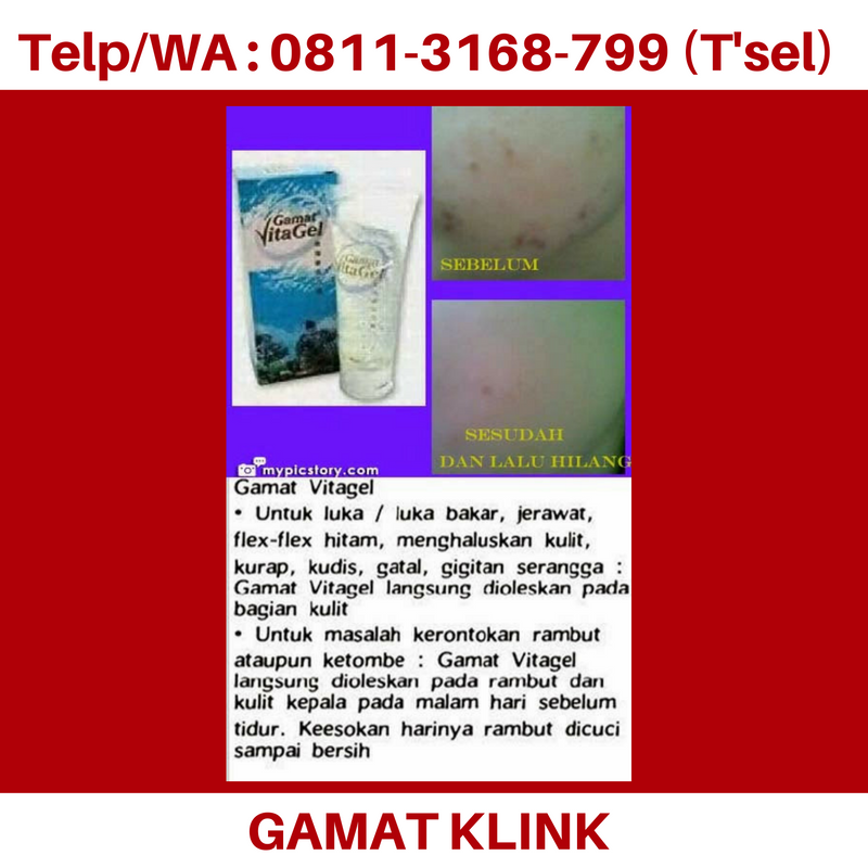 0811-3168-799 (T'Sel), K Link Gamat Gel: 0811-3168-799 (T'Sel), K Link ...