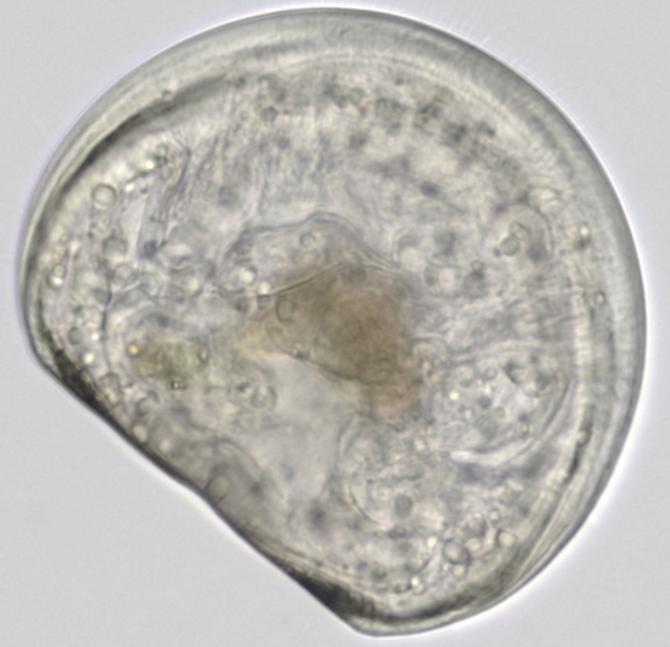 Invertebrate Embryology: Veliger larvae of molluscs