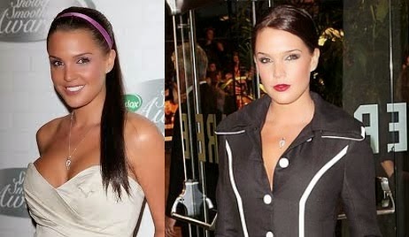 Danielle Survivor Implants