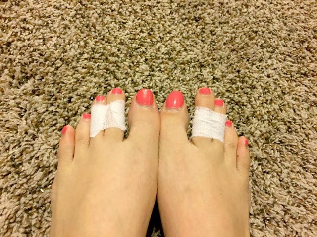 SO MANY WOMEN NOW TAPE THEIR MIDDLE TOES TOGETHER, AND YOU’LL WANT TO ...