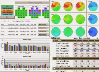 Clínica Simioni: Neurofeedback HEG (Hemoencefalografico)