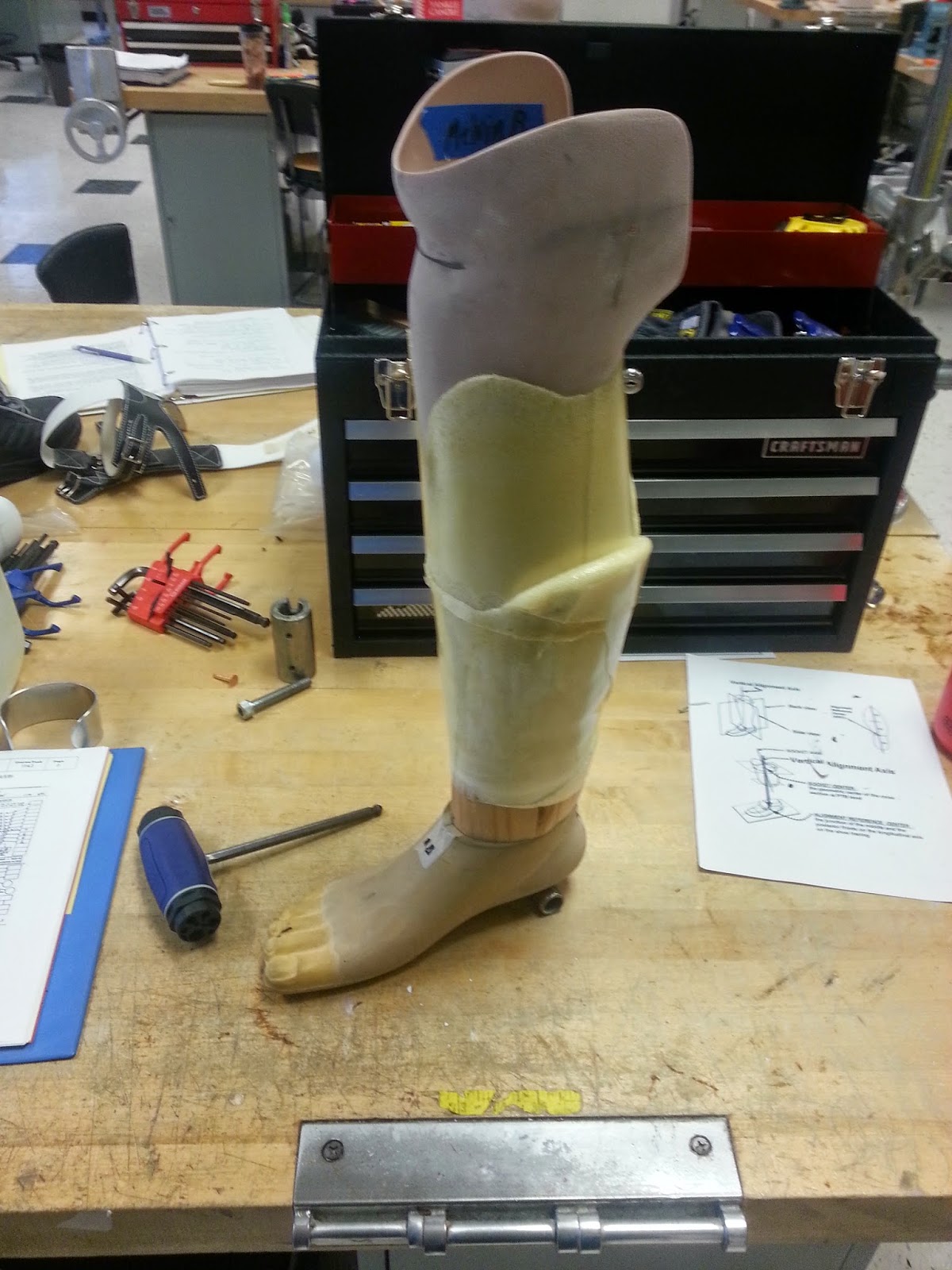 Prosthetic Projects: PTB Exoskeletal Prosthesis
