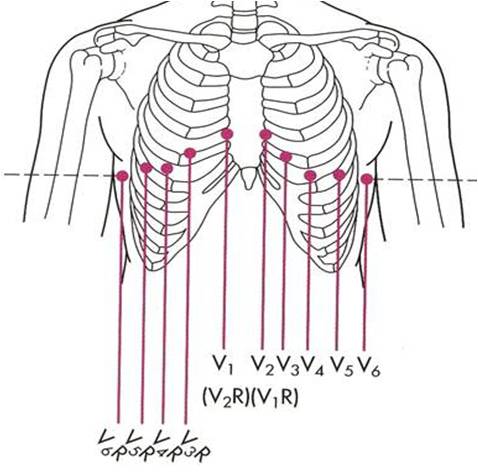 Medsign: Dasar-dasar EKG: Bagian 1
