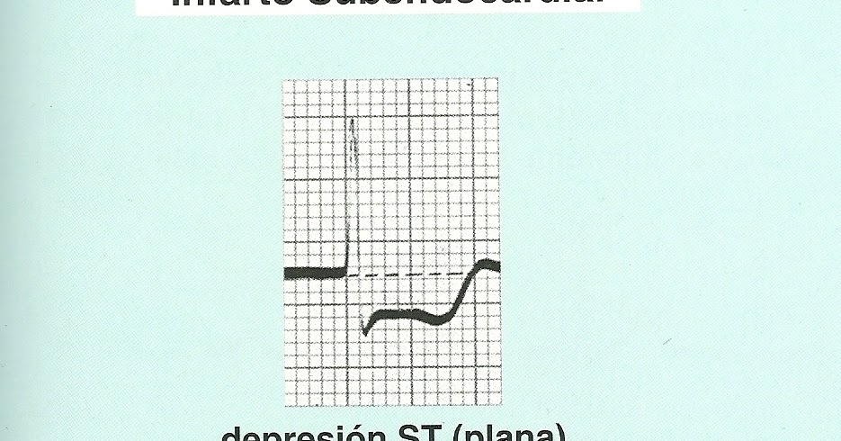 Dr. Rafael Soto - Cardiocito en construcción y electrocardiograma ...