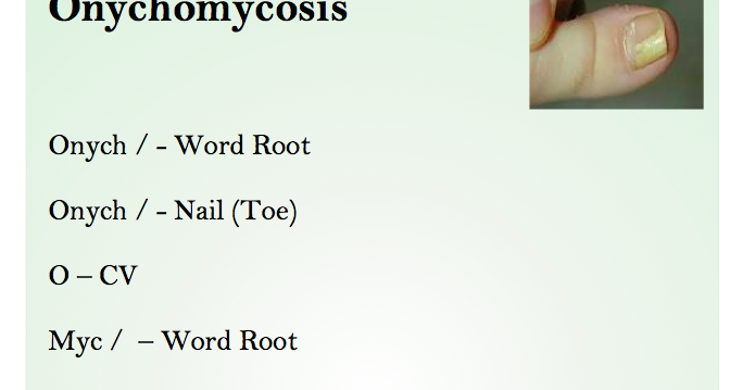 Easy Medical Terminology : Onychomycosis Toenail Fungus