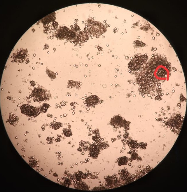 BENDA ERGASTIK ALEURON PADA TUMBUHAN