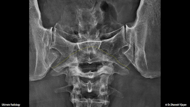 Ultimate Radiology : 2017