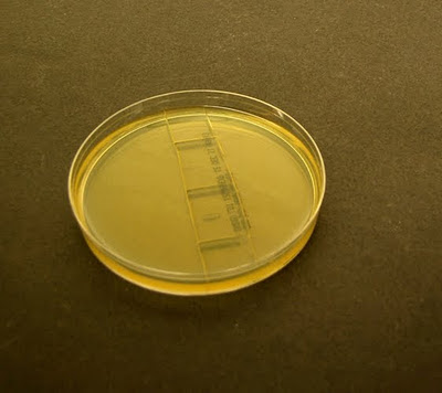 Fun With Microbiology (What's Buggin' You?): Slide Culture Technique