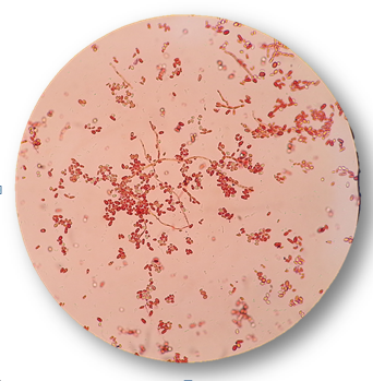 Micología Clínica Bioanálisis Xalapa: CANDIDA spp por:( Hector Ivan ...