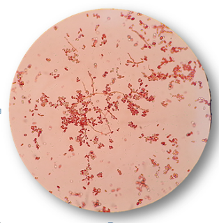 Micología Clínica Bioanálisis Xalapa: CANDIDA spp por:( Hector Ivan ...
