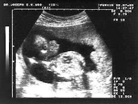 18 Week Fetus Development