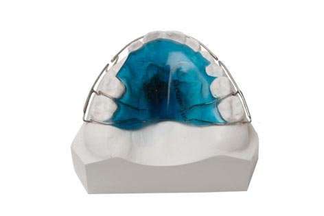 DISEÑAR LOS PATRONES DE APARATOLOGIA: PLACA DE HAWLEY ARCO SOLDADO A ADAMS