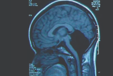 Los tres Cerebros más extraños jamás vistos