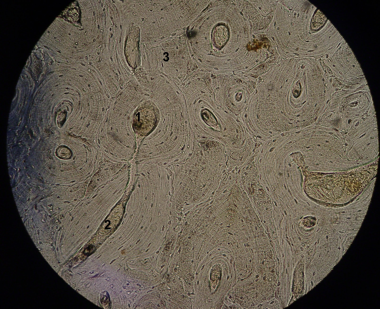 Histologia UFJF: Tecido Ósseo - Osso Compacto