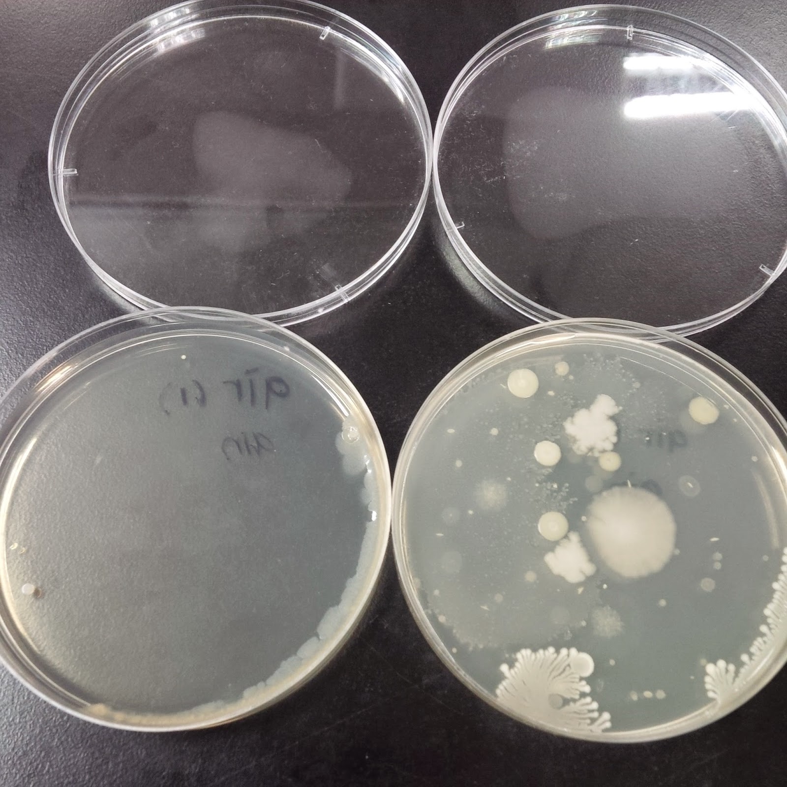 Lab IBG102: Lab 4 : Sources of Contamination and Infection