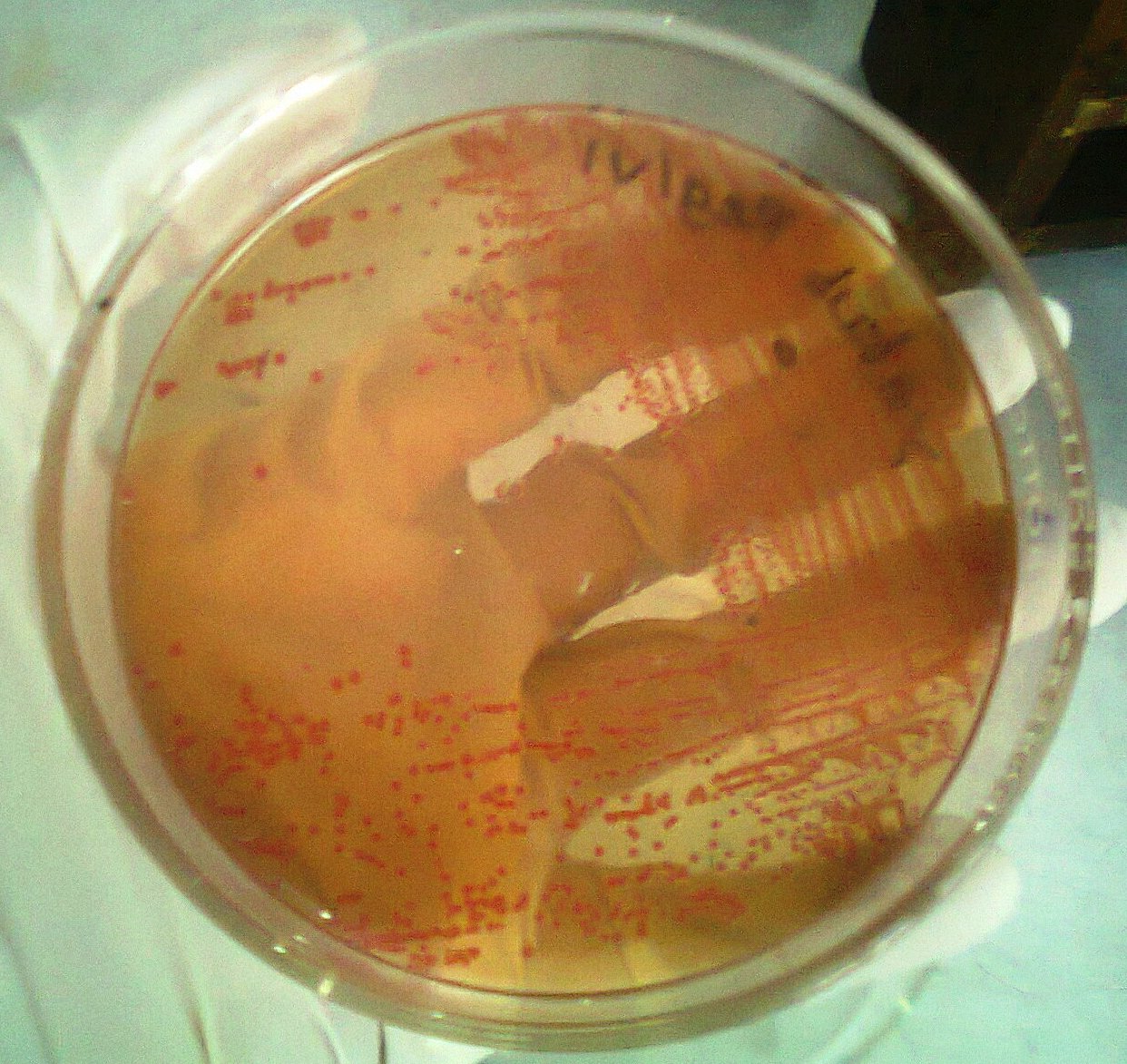 Kultur dan Hasil Uji Biokimia Bakteri Gram Negatif ~ Analis Kesehatan ...