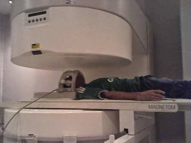 Síndrome de Machado Joseph