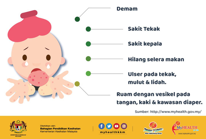 HFMD - Info Penting, Cara Rawatan dan Bagaimana Cegah Supaya Tidak ...