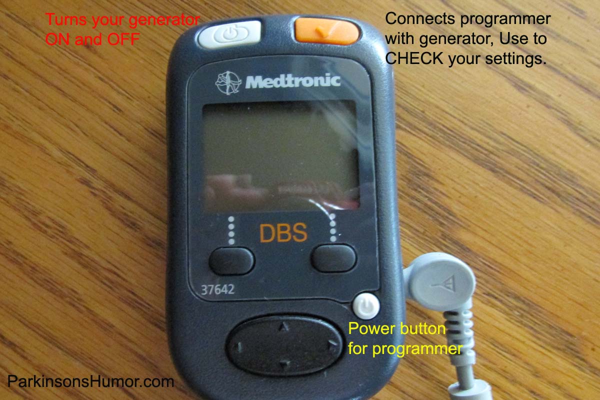 My DBS Story: How to Track Your DBS Generator Battery Life Using the ...