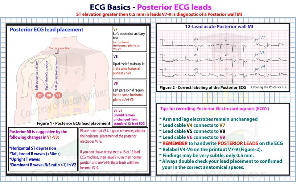 Residencia CM-HCM: DERIVAÇÕES POSTERIORES. Autor: Jason Winter