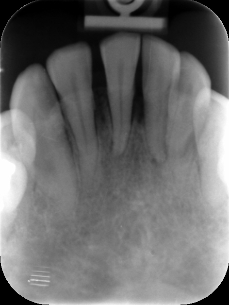 Presentacion de Caso Clinico de Clinica Integral I