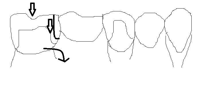 Pier (intermediate) bridge abutments