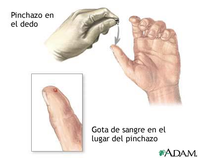 Flebotomia : Puncion Capilar