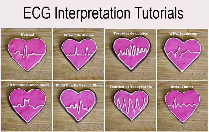Medical Laboratory and Biomedical Science: ECG Interpretation Tutorials