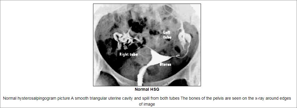 Our Journey to Parenthood with Infertility Issue (Low Sperm Count)!: 2018