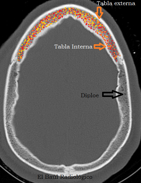 Muito bom esse café !: Anatomia - O Crânio (vista anterior e superior)