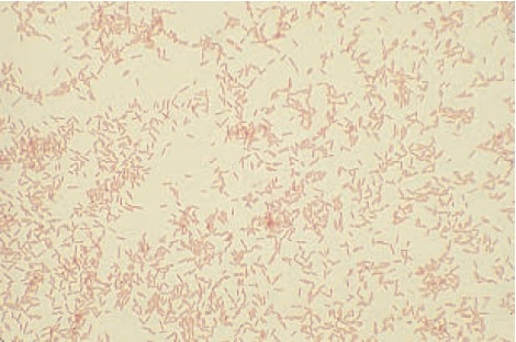 [Microbiology] Atlas of Haemophilus and Other Fastidious Gram-Negative ...