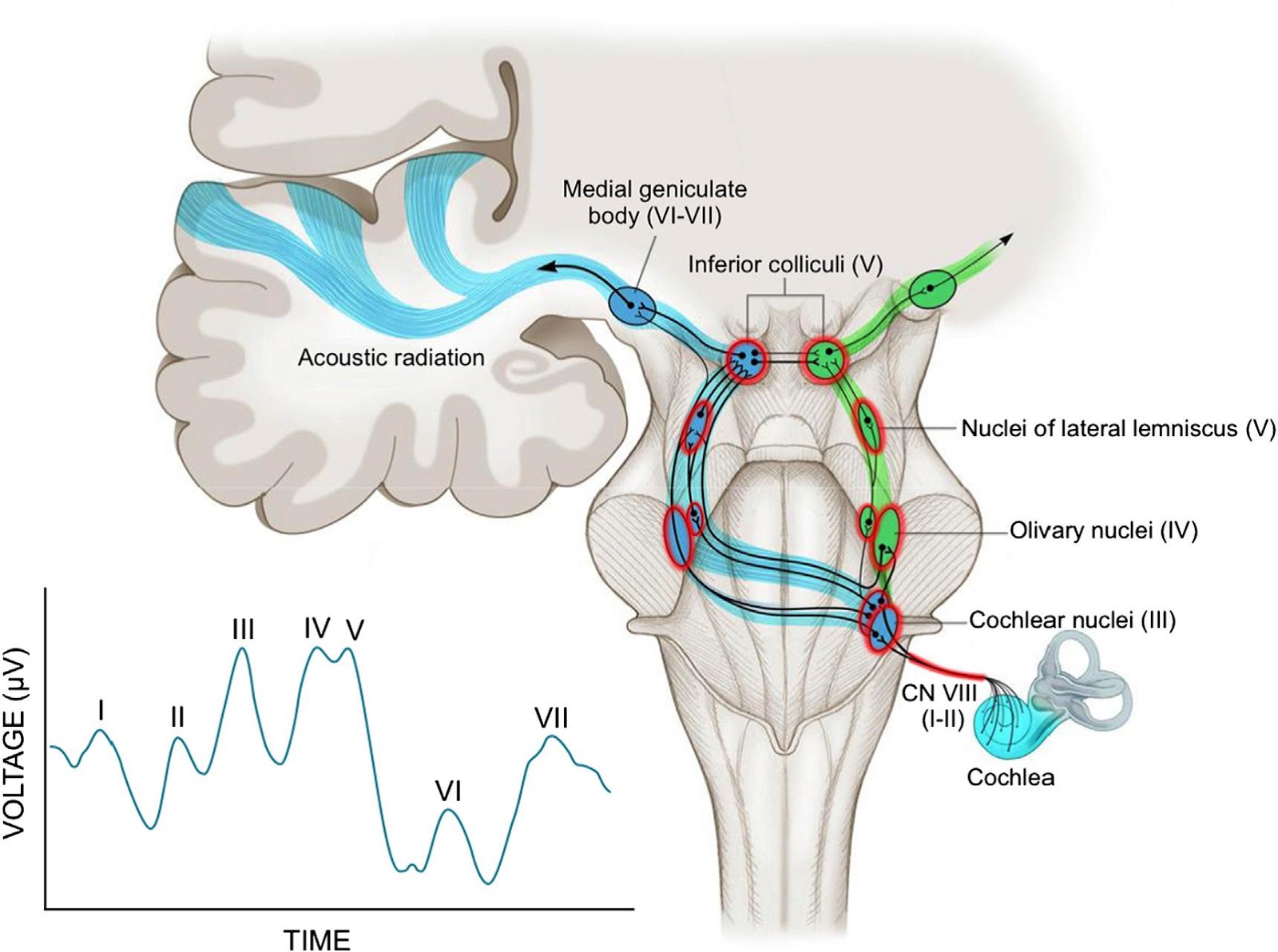 Brainstem Audiotory Evoked Potentials In Adhd
