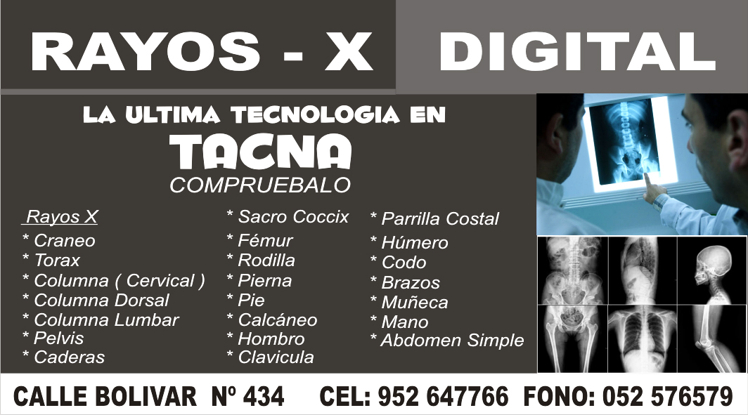 servicios que ofrece Tacna - Perú: RAYOS - X DIGITAL