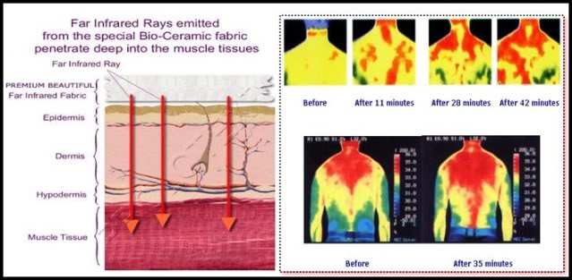 Premium Beautiful VS Perut Buncit: Fakta Far Infrared Rays