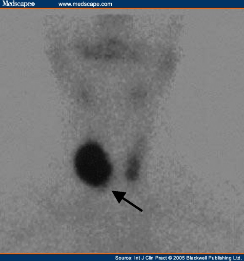 Lecture Notes in Medical Technology: Lecture #6: THE ENDOCRINE SYSTEM