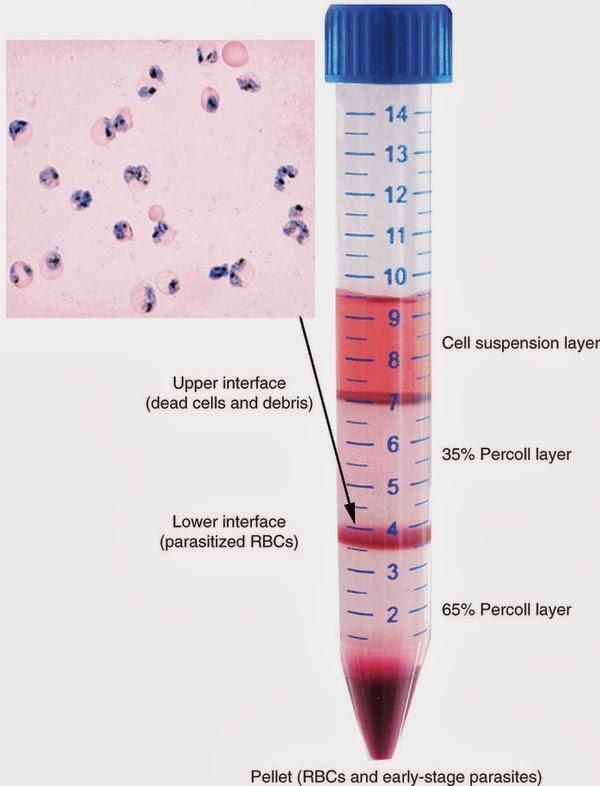 MEDECINE à Madagascar à partir de 1897...: Paludisme - Tazomoka - 5
