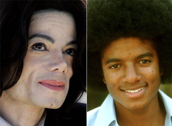 Starhooks * * *: Male Celebrities Who Have Admitted To Plastic Surgery ...