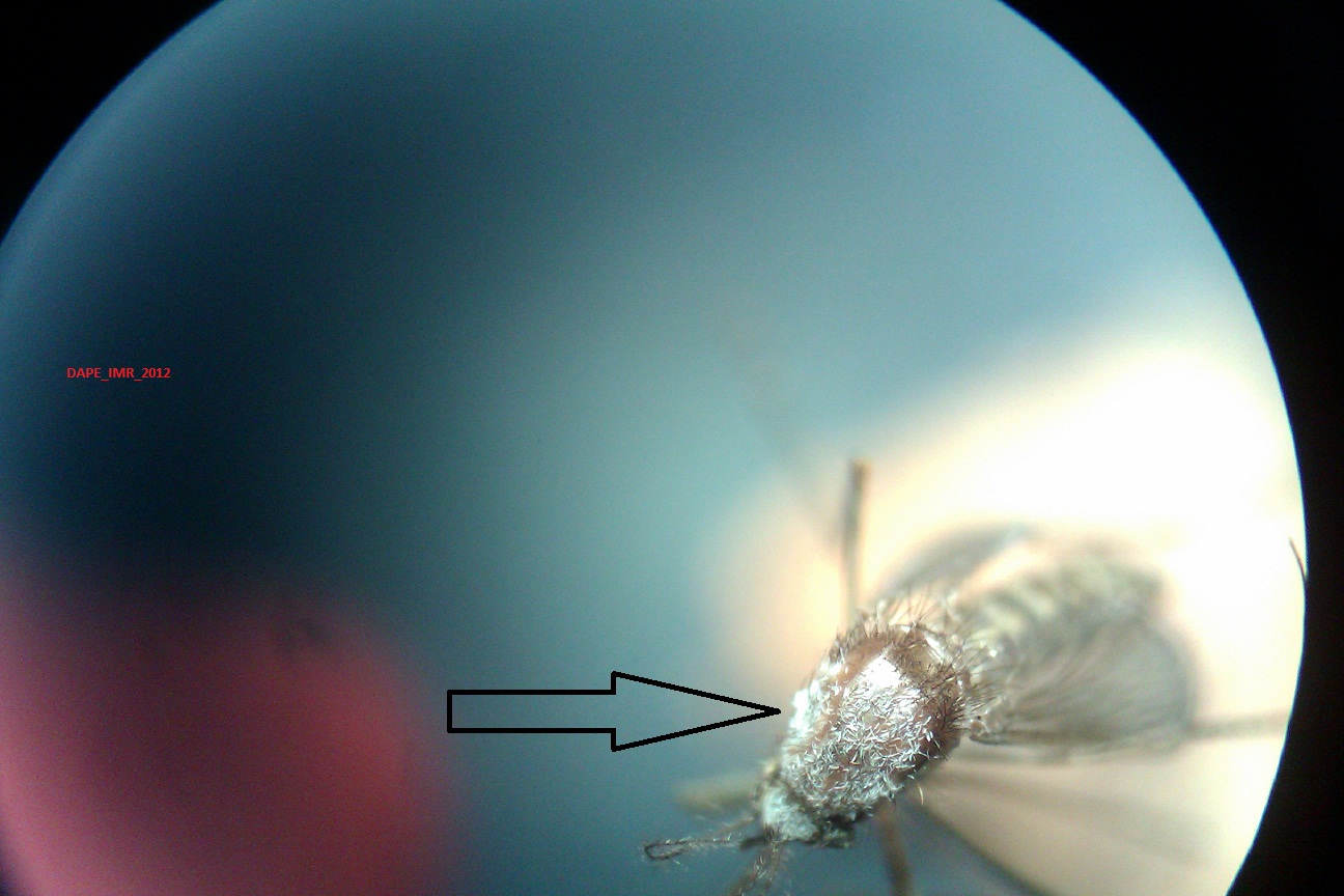 MEDICAL ENTOMOLOGY: Identification of Culex sp. (Adult)