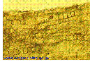 เรียนชีววิทยา กับครูกศนต์ ภารยาท: 4.4 อาณาจักรฟังไจ (Kingdom Fungi)