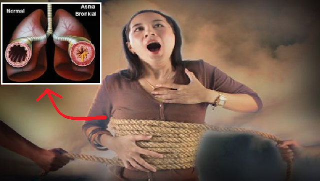Dengan Buah Ini, Serangan Asma Mendadak Bisa Disembuhkan, Semoga ...
