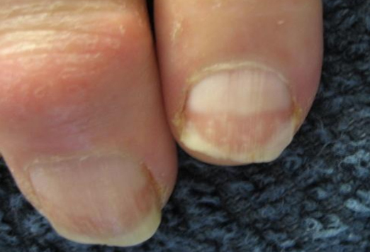 World's Tragic In Medlife,.....You May Know Or Not