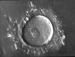 Bioética y vida humana: El Hombre-Dios fue un cigoto humano