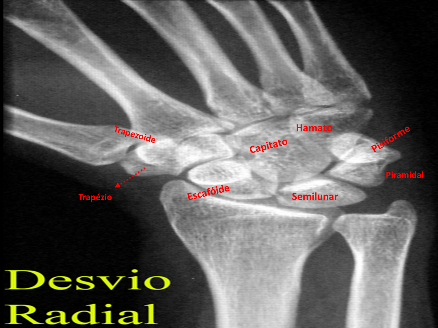 Laboratório de Roentgen: Membros Superiores Parte 1